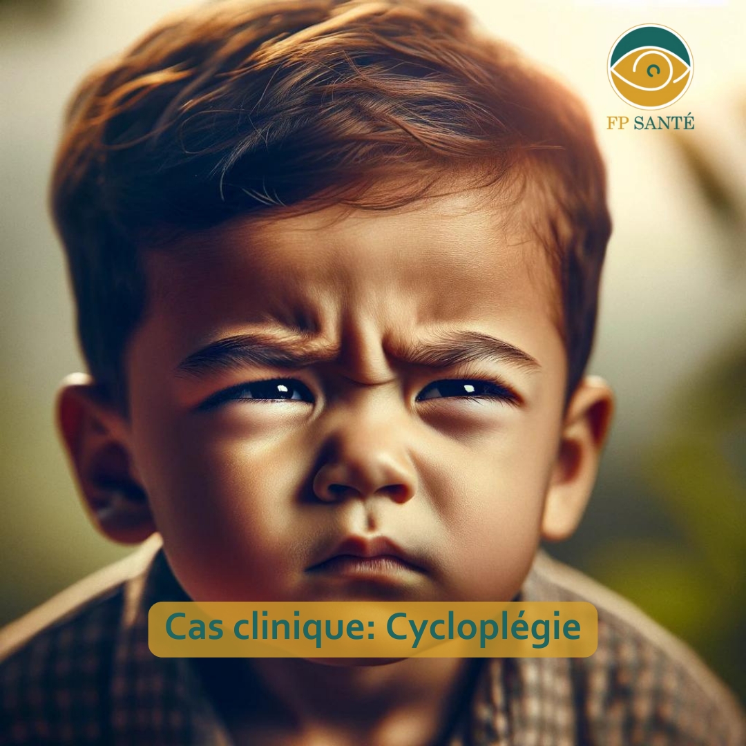 La cycloplégie en ophtalmologie pédiatrique - Formation Pédagogie Santé